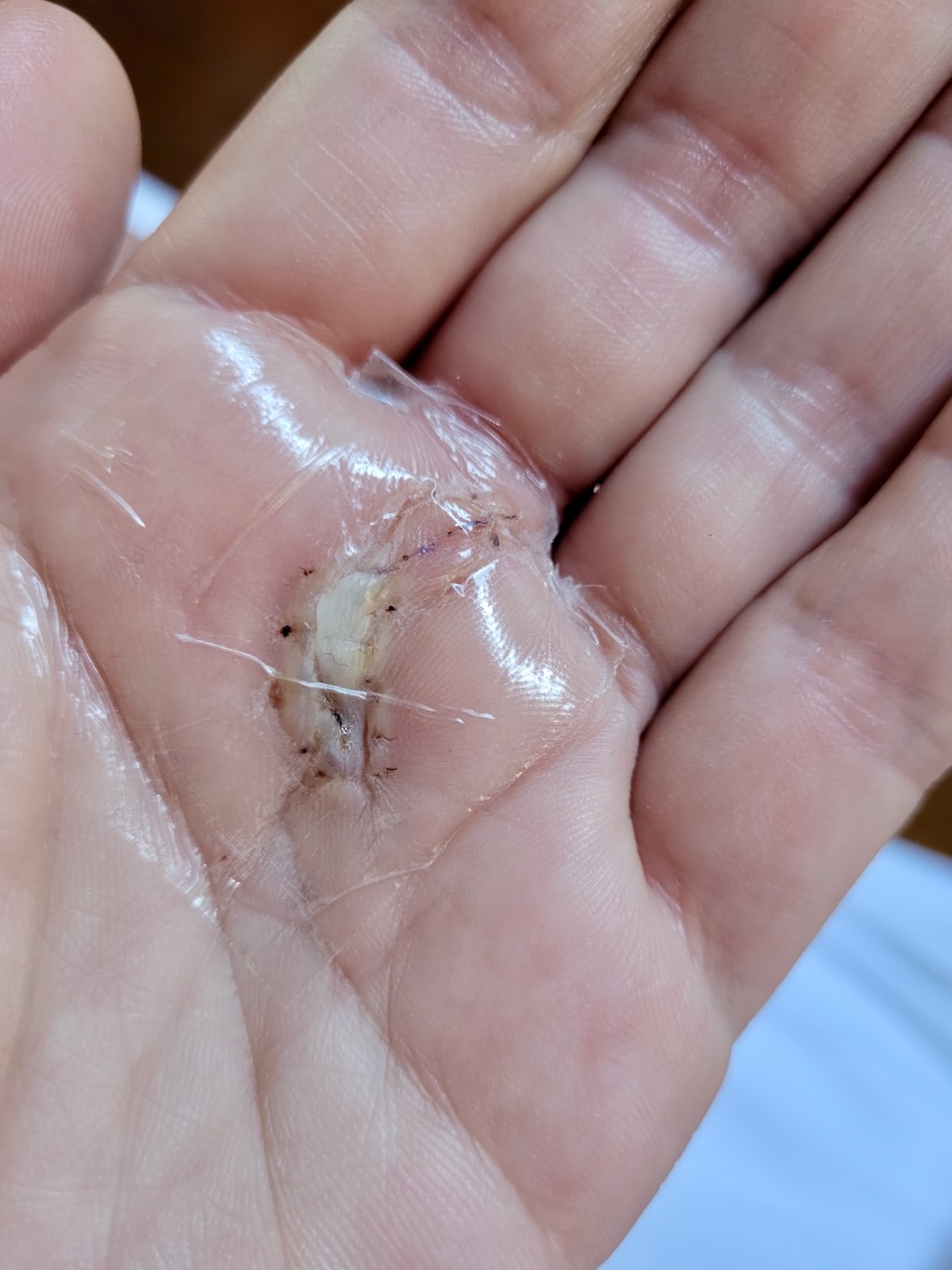 Left Hand Laceration | TheJessicaness